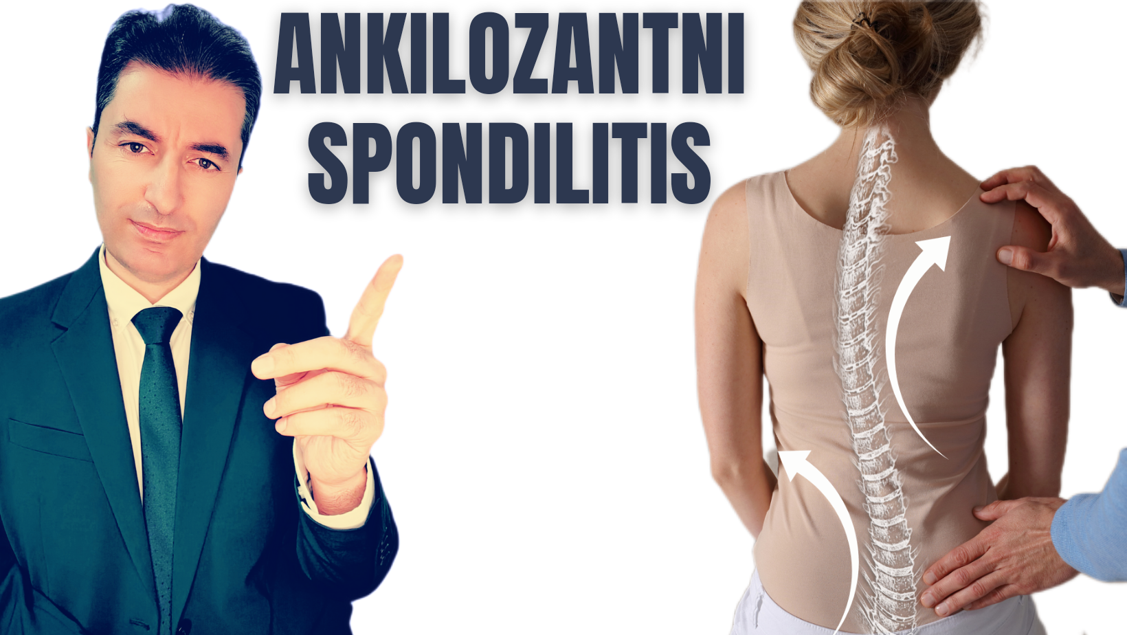 Koji su simptomi ankilozantnog spondilitisa? - MarioLAB