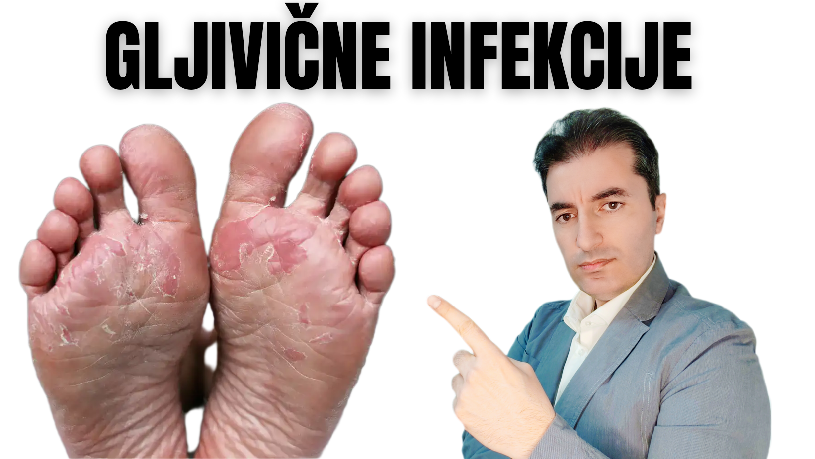 How to remove fungal infections of the feet in a natural way? - MarioLAB