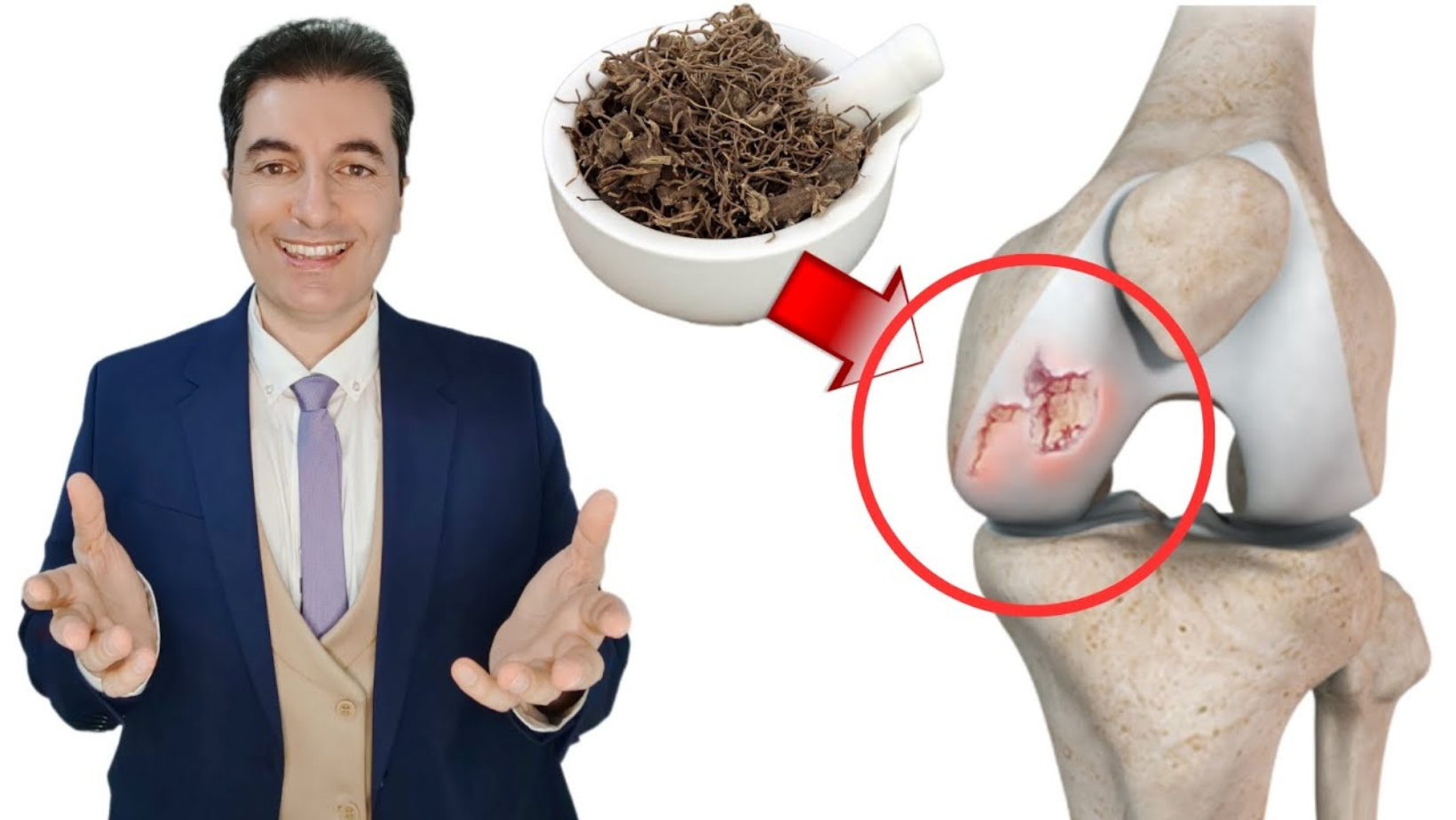 Prévenir l’arthrose du genou avec le cohosh noir - MarioLAB