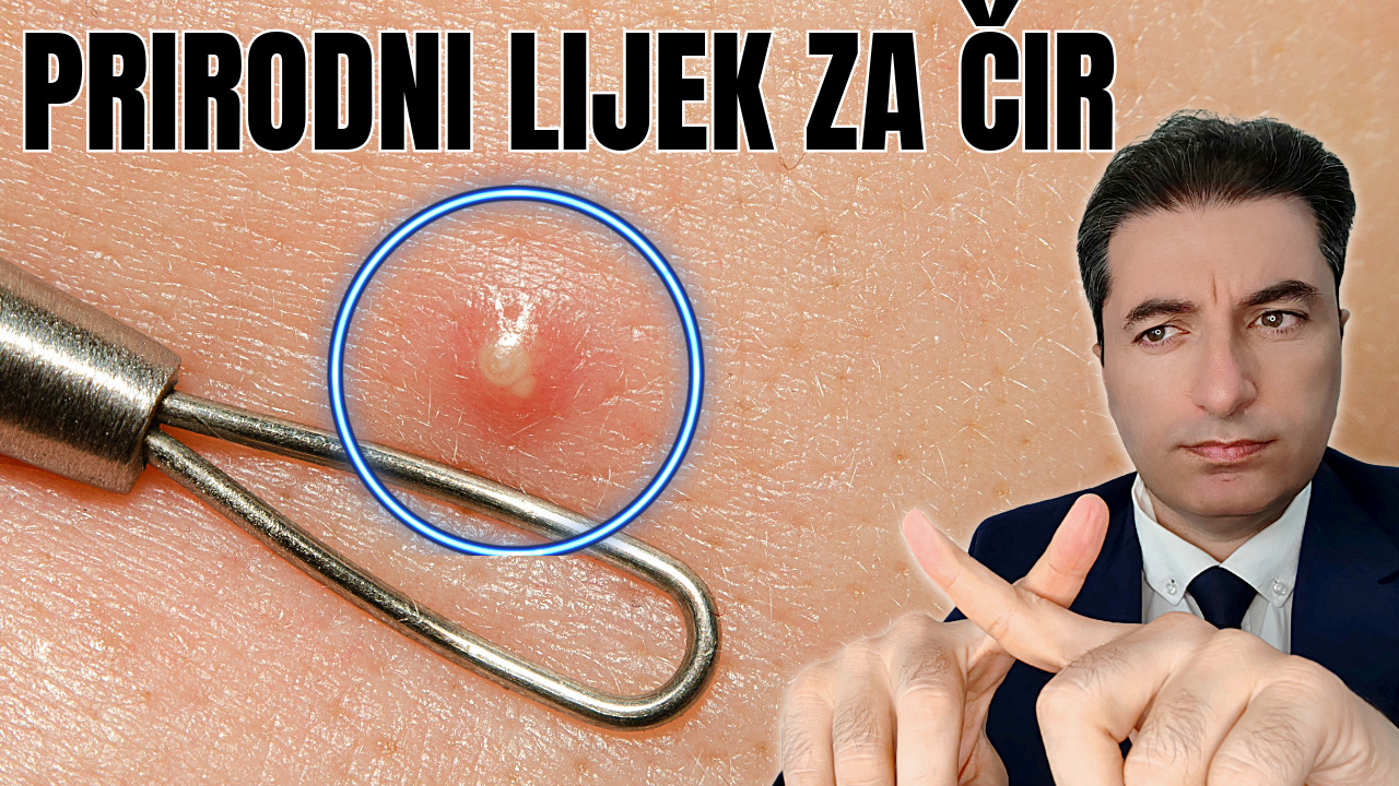 Purulent ulcers (abscesses) – cause, treatment and the best natural ...